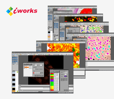 Microscope Camera, Metallographic Software | Lanoptik Technologies